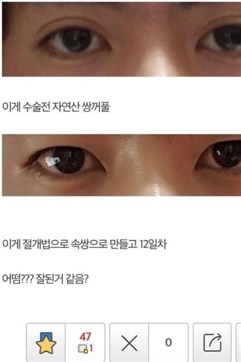 남자 눈성형 레전드 남자 재미있는 것들 유머 감각