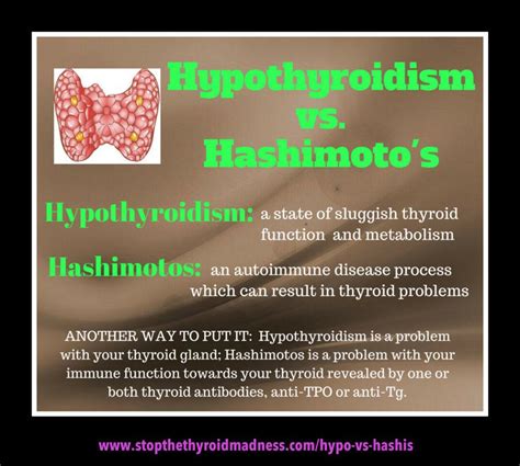 Hashimotos Thyroiditis