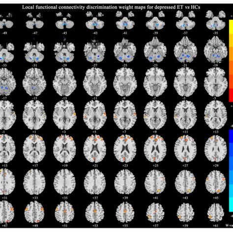 The Brain Regions Of Significant Discriminative Features In The Download Scientific Diagram