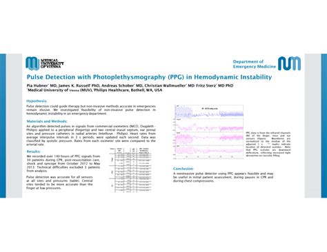 Pdf Pulse Detection With Photoplethysmography Ppg In Hemodynamic