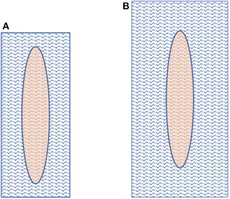 Fascial Gap Size In Comparison To Mesh Size The Left Image A Depicts Download Scientific
