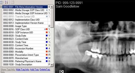 Dicom Data Set Sdk Technology Leadtools