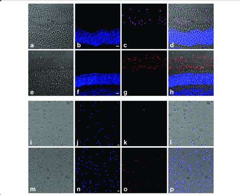 Identification Of Cone Photoreceptors Types By Immunoreactive Opsin