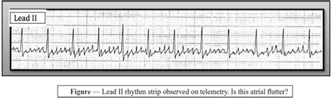 ECG Review Flutter Or The Patient AHC Relias Media