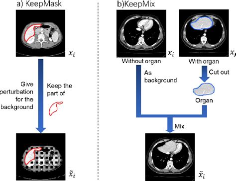 Figure From Mixing Data Augmentation With Preserving Foreground Regions In Medical Image