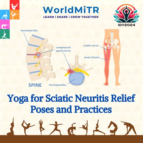 Sanya Goutham On Linkedin Yoga For Sciatic Neuritis Relief Poses And
