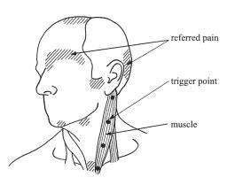 Trigger Point Manual