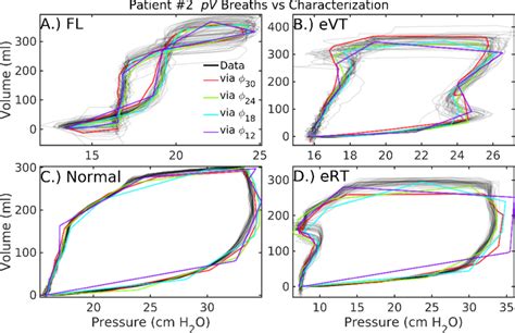 Patient 2 Pv Loop Characterizations At Various Parameter Resolutions