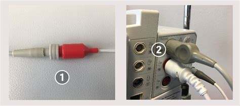 Thermodilution Measurement