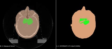 What Is The Best Way To Iterate Through Dicom Image Data With Rtstruct Contours In A Loadable