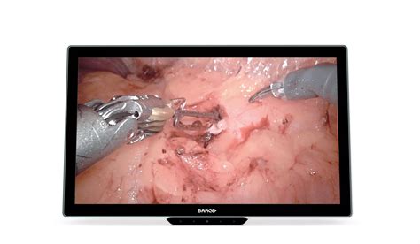 Mdsc 8527 4k Uhd Surgical Display Limited Quantity Available £2000 Off List Price Jones Av