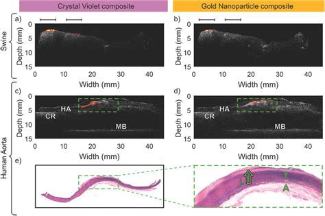 Multi Modality Imaging For Minimally Invasive Surgery Ucl Epsrc Centre For Doctoral Training