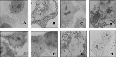 Adherence Of Bacteria To Hep 2 Cells In Culture After A Standard 3 H Download Scientific