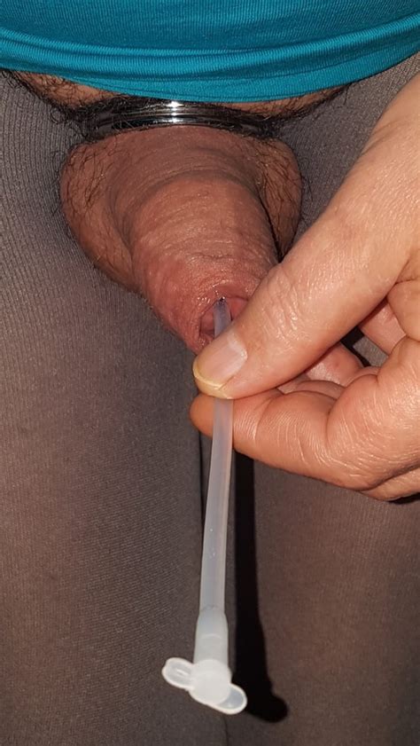 Souding Catheter 41 Pics Xhamster Souding Catheter 41 Pics Xhamster
