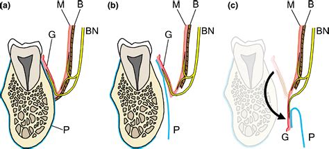 Buccal Dental Block At Joshua Allingham Blog