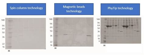 High Throughput Protein Purification Strategies Biotage