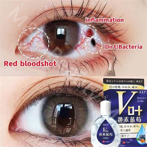 Japanese Eye Drops 15mb Blueberry Lutein Eye Drops Used To Treat Aging