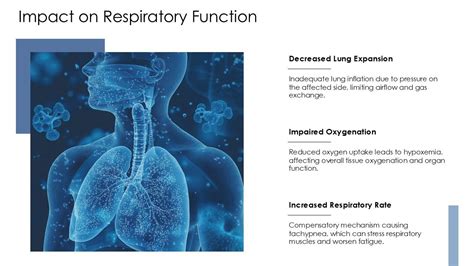 Deviated Trachea Tension Pneumothorax Ppt Template Acp Ppt Slide