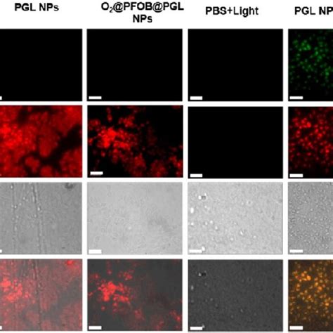 Intracellular Ros Detection By Fluorescence Microscopy After Ht 29