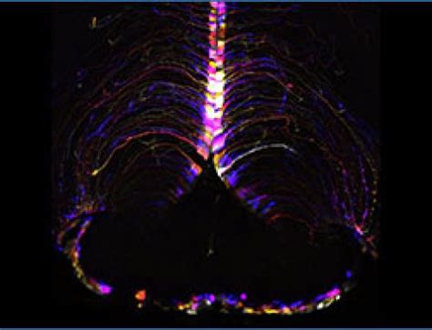 High Resolution Transcriptome Analysis With Long Read Rna Sequencing Rna Seq Blog