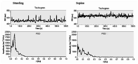 Tachogram And Corresponding Power Spectral Density Psd Of A Standing