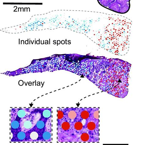 Somatic Point Mutations Are Detectable In Spatial Transcriptomics Data Download Scientific
