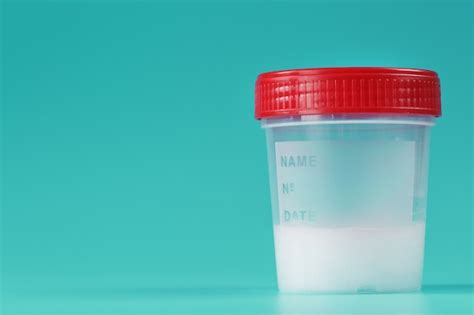 Premium Photo A Container For Biomaterials With Sperm Analysis