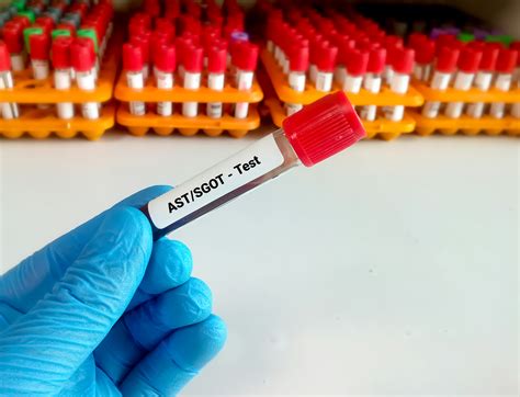 Transaminases Sgpt élevé Causes Et Traitements