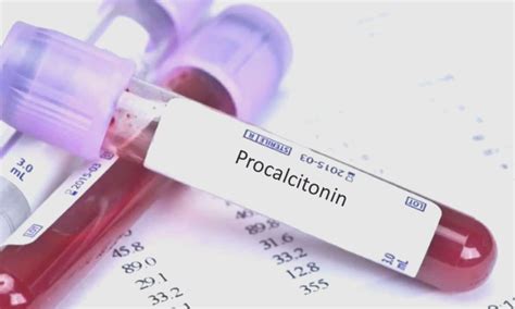 Procalcitonin Testing Flops In Reducing Antibiotic Duration For Treating Respiratory Infections