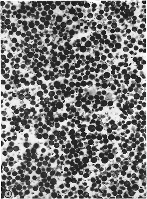 Electronmicrograph Of A Purified Small Granule Fraction X 17 600