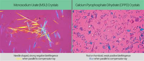 Chaos Complexity And Complicatedness Features And Diagnosis Of