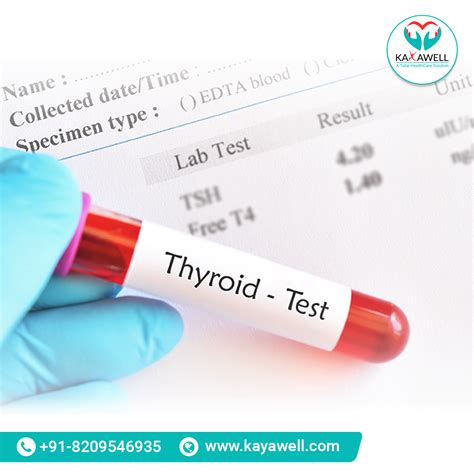 Thyroid Test At Home Kayawell