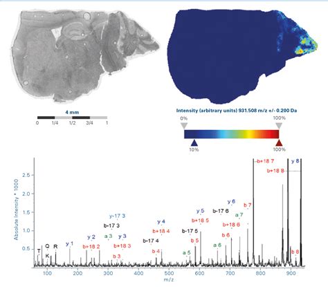Figure 1 From High Speed Maldi Tof Tof Imaging Of Mouse Brain Tissue Performed On Intact