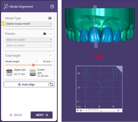 Model Creator Module Exocad