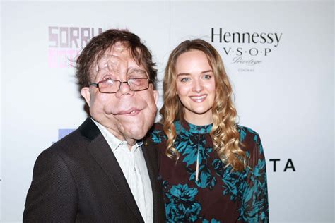 The Incredible Story Of Adam Pearson He Became A Movie Star Despite His Genetic Disorder