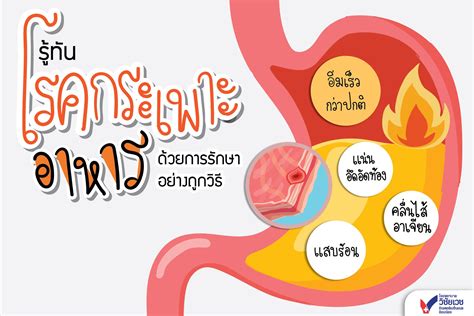 ข่าวสารและกิจกรรม กลุ่มโรงพยาบาลวิชัยเวช อินเตอร์เนชั่นแนล ดูแลชีวิต ด้วยจิตใจ