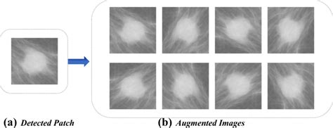 Example Of Data Augmentation Method A Detected Patch Roi B