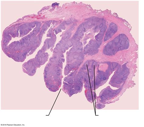 Aandp Ii Chapter 22 Palantine Tonsil Slide Diagram Quizlet