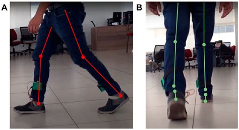 Figure 6 From Development Of 3d Printed Orthopedic Insoles For Patients With Diabetes And