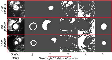 Representative Examples Showing The 5 Out Of 8 Most Semantic