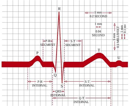 Describe The Features Of A Normal Ecg Or Ekg