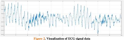 Figure 2 From Classification Of Arrhythmia Diseases By The Convolutional Neural Network Method
