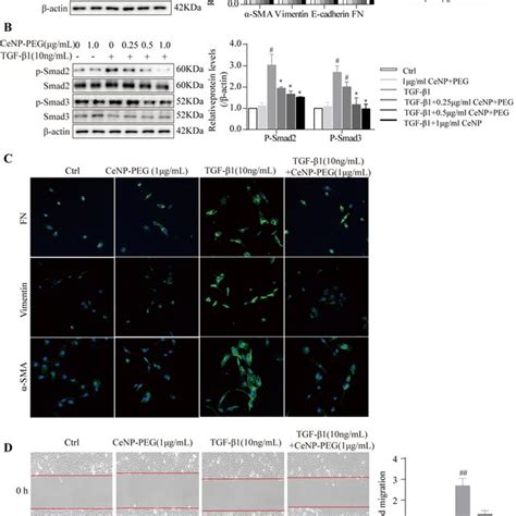Cenp Peg Protected Hk 2 Cell From Tgf β1 Induced Emt Process A The