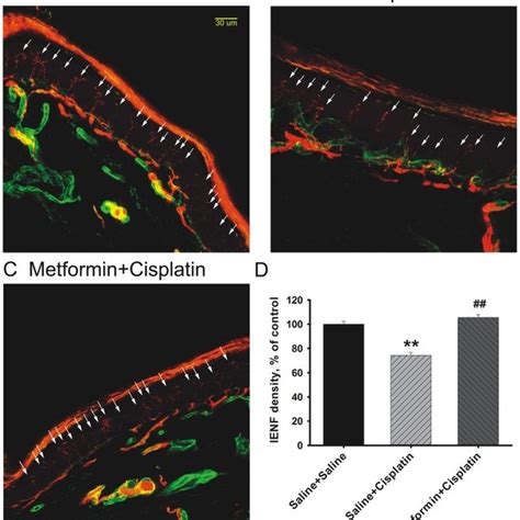 A Mice N 610group Were Treated With Cisplatin And Metformin As Download Scientific