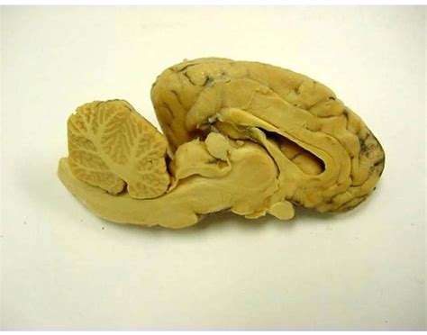 Label The Parts Of A Dissected Sheep Brain Quiz