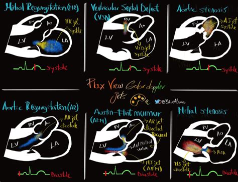 Cardiac Ultrasound Echocardiography Made Easy Step By Step Guide Artofit