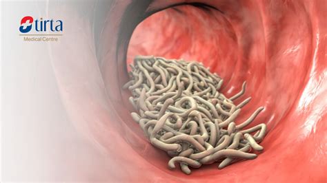 Tes Urine Jenis Manfaat Prosedur And Harga Tes