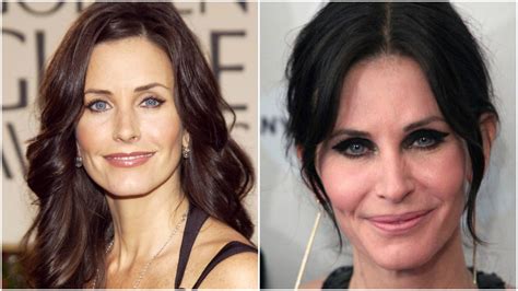 What Plastic Surgery Has Courteney Cox Had Trlp
