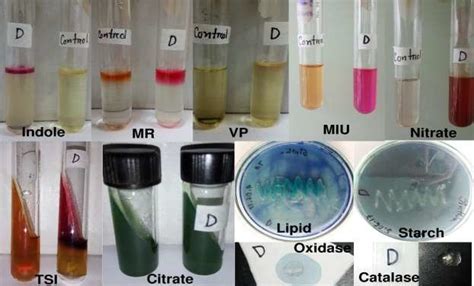 Pseudomonas Aeruginosa Isolation And Identification