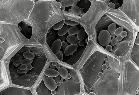 Potato Cells Labeled Starch Solved Potato Coll Key 5 A Cube Cut From